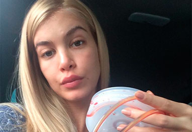 Kat Torres, affair de Leonardo Di Caprio, retira um dos seio - OFuxico