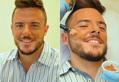 Erich Pelitz aposta em máscara de chocolate - OFuxico