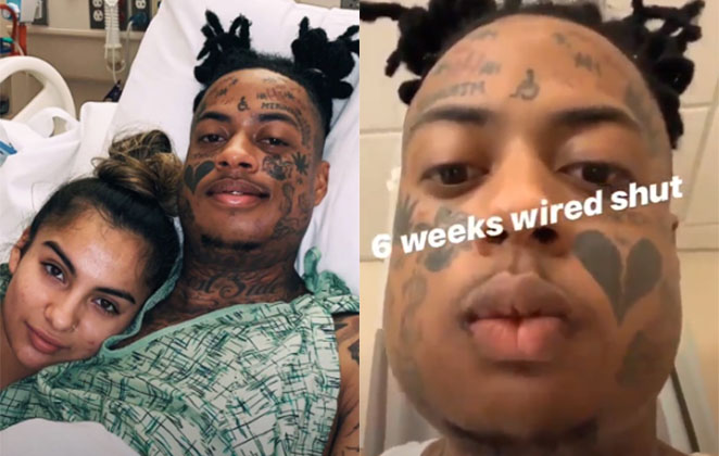 Rapper leva soco na boca e quebra a mandíbula. Veja o vídeo! - OFuxico