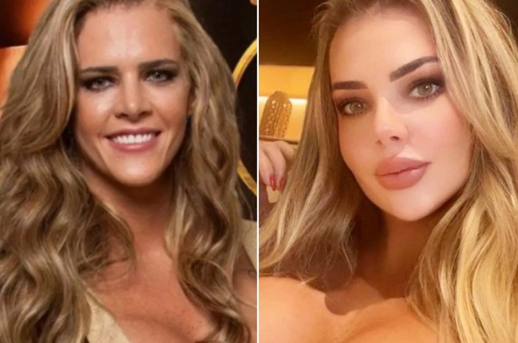 Antes e Depois: Denise Rocha revela procedimentos que fez