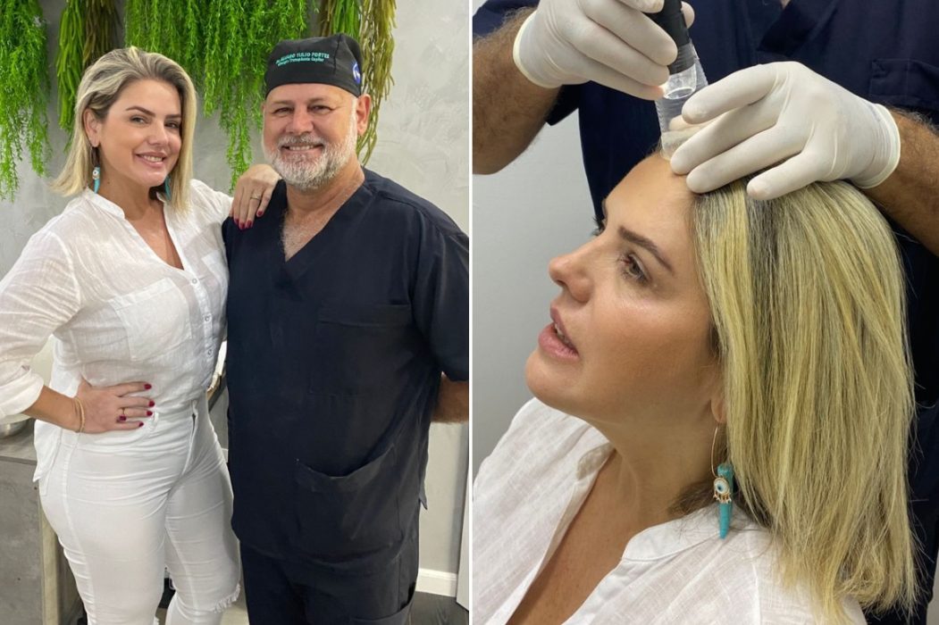 Mari Alexandre se submete a microinjeções no couro cabeludo