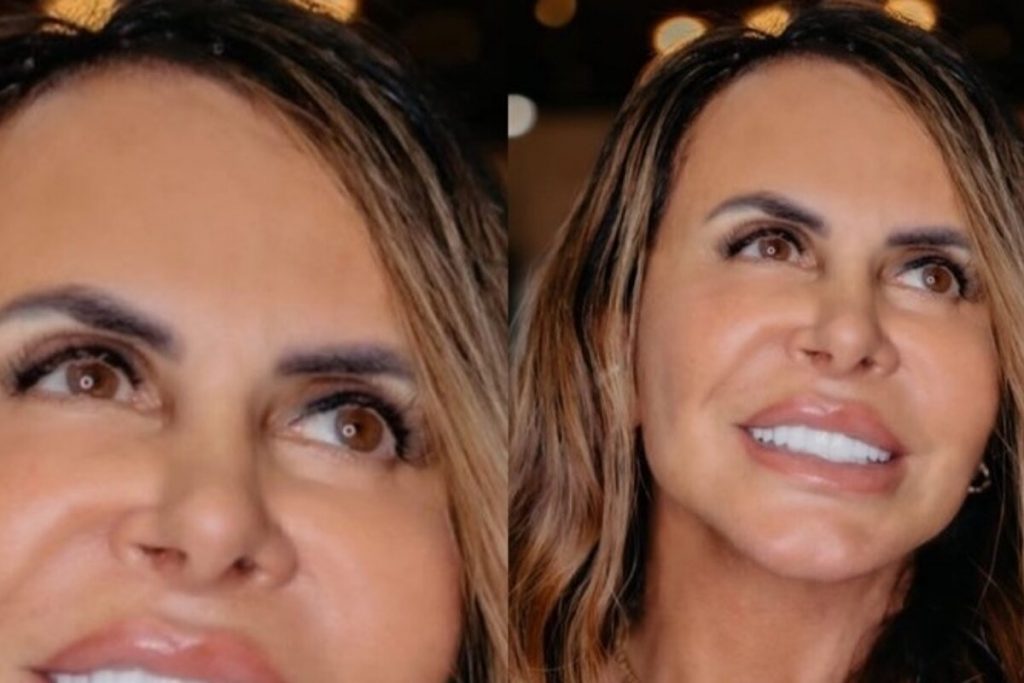 Gretchen comenta sobre preenchimento vaginal: 'Libido sempre dez'