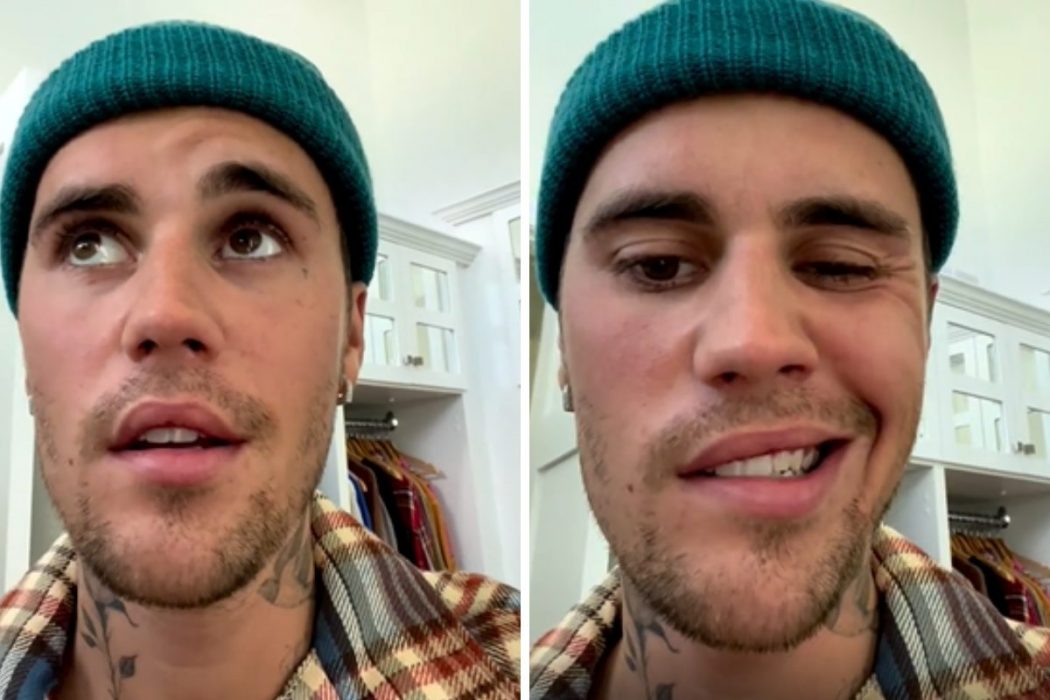 Entenda a condição que paralisou metade do rosto de Justin Bieber