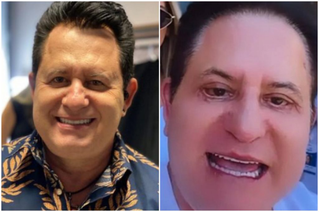 Namorada aprova plástica de Marrone: 'Conseguimos o que queríamos'