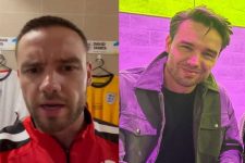 Fãs acham que Liam Payne fez harmonização facial