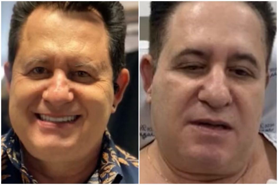 Marrone volta ao hospital escondido para refazer cirurgia, diz colunista