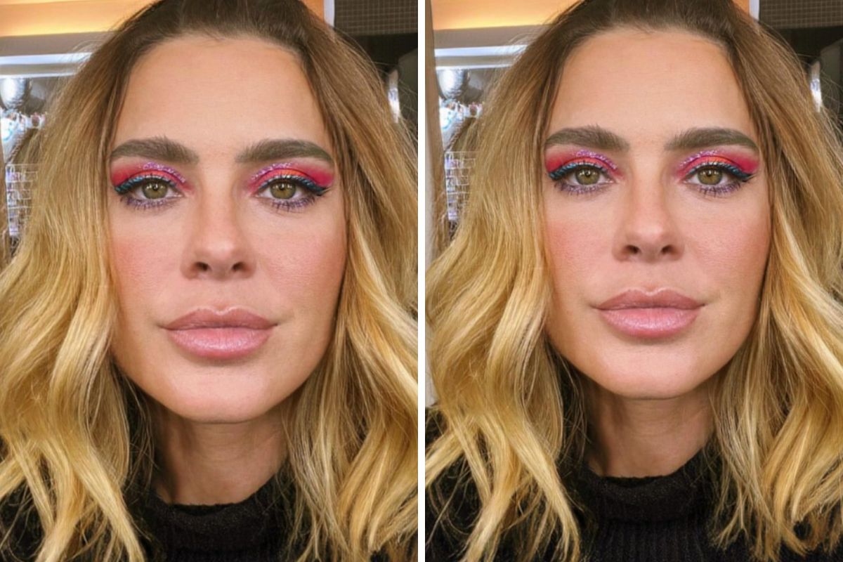 Carolina Dieckmann preocupa fãs, com o rosto inchado: 'Não sarava'