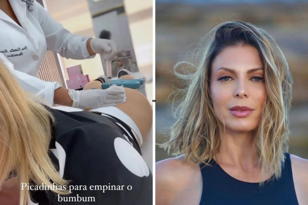 Sheila Mello faz procedimento para empinar bumbum. Veja resultado!