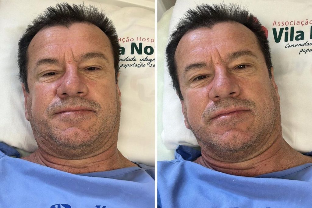 Dunga, ex-técnico da seleção brasileira, passa por cirurgia delicada