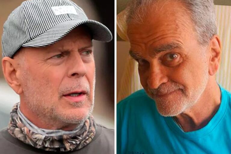 Entenda a DFT, doença que afeta Maurício Kubrusly e Bruce Willis