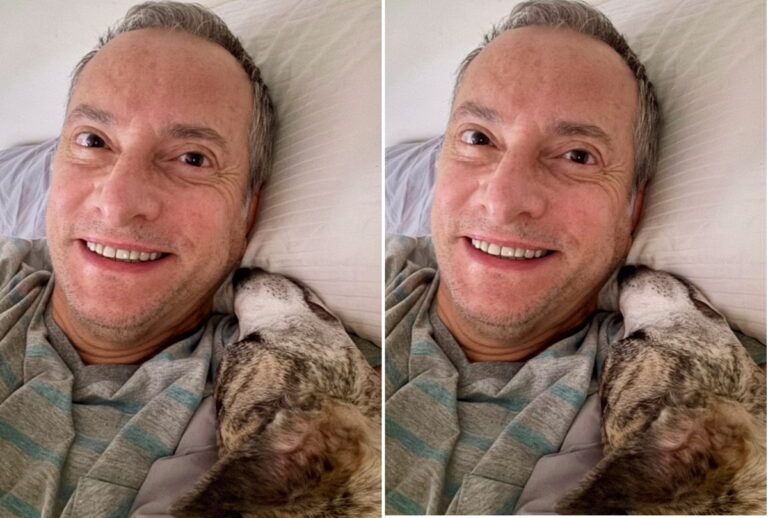 José Roberto Burnier fala da recuperação, após infarto - OFuxico