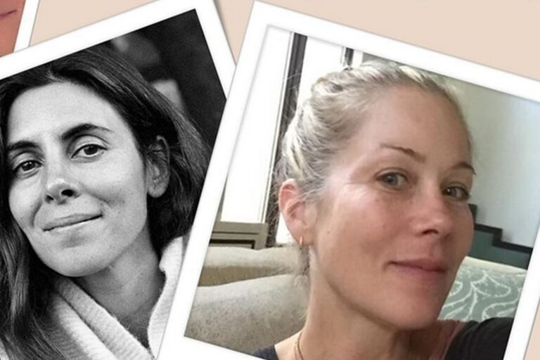 Atrizes com esclerose múltipla estreiam podcast sobre a doença