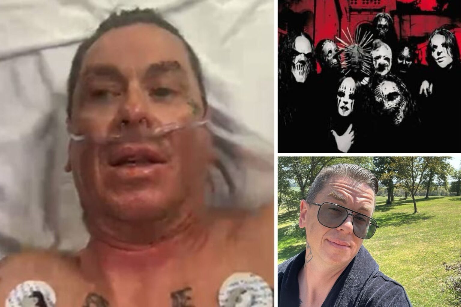 Sid Wilson, do Slipknot, sofre acidente e fica com queimaduras graves ...