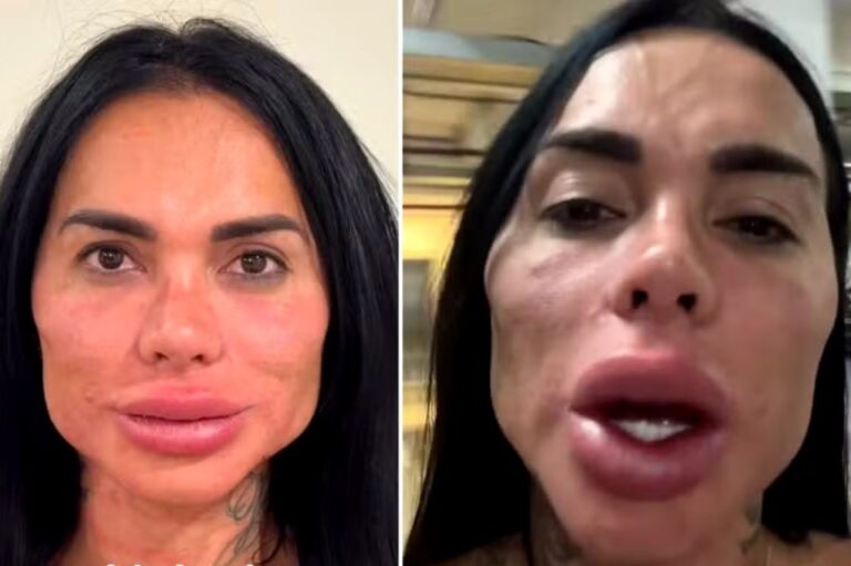 Kamila Simioni exibe novo visual após harmonização facial - OFuxico