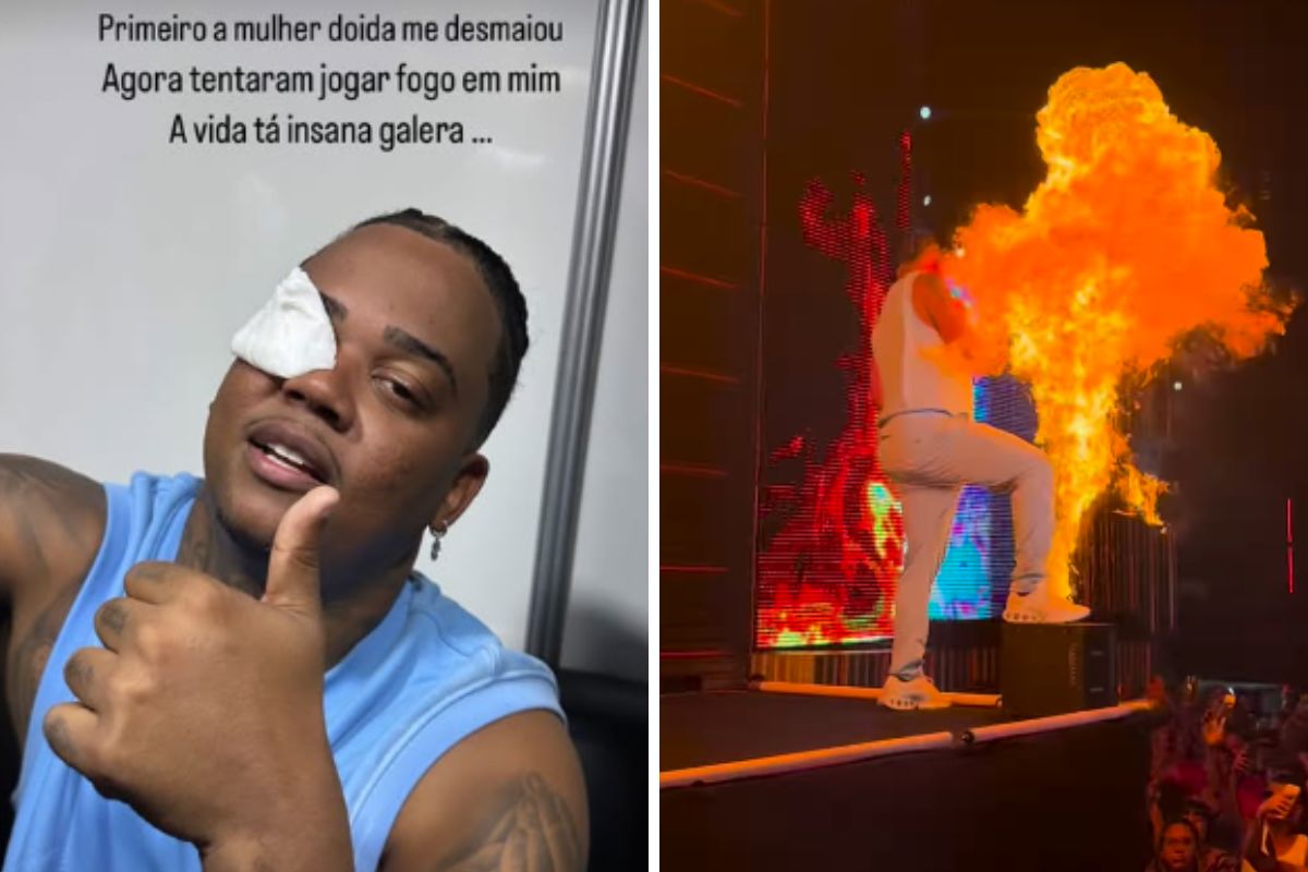 Rapper Major RD sofre acidente com fogo em festival no Rio - OFuxico
