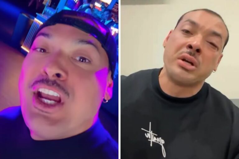 Felipe Franco relata agressão em show de Chris Brown e mostra olho ...